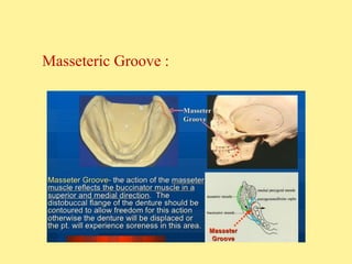 Role of facial muscles in complete denture prosthesis | PPTX