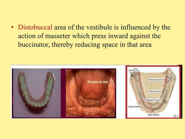 Role of facial muscles in complete denture prosthesis | PPTX | Dental ...