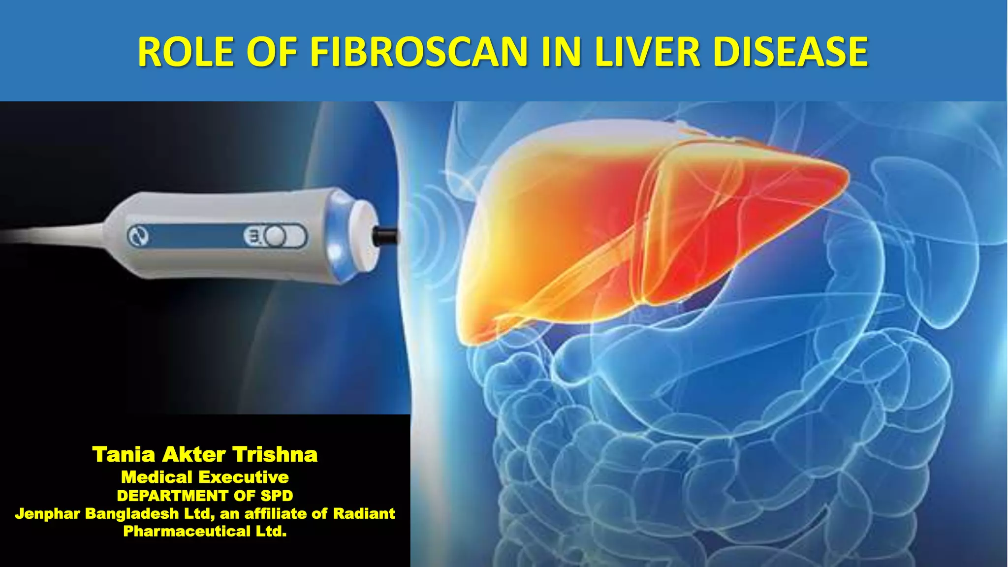 Role of Fibroscan in Liver Disease Ppt | PPTX