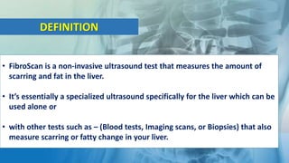 Role of Fibroscan in Liver Disease Ppt | PPTX