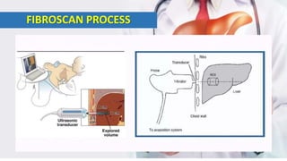 Role of Fibroscan in Liver Disease Ppt | PPTX