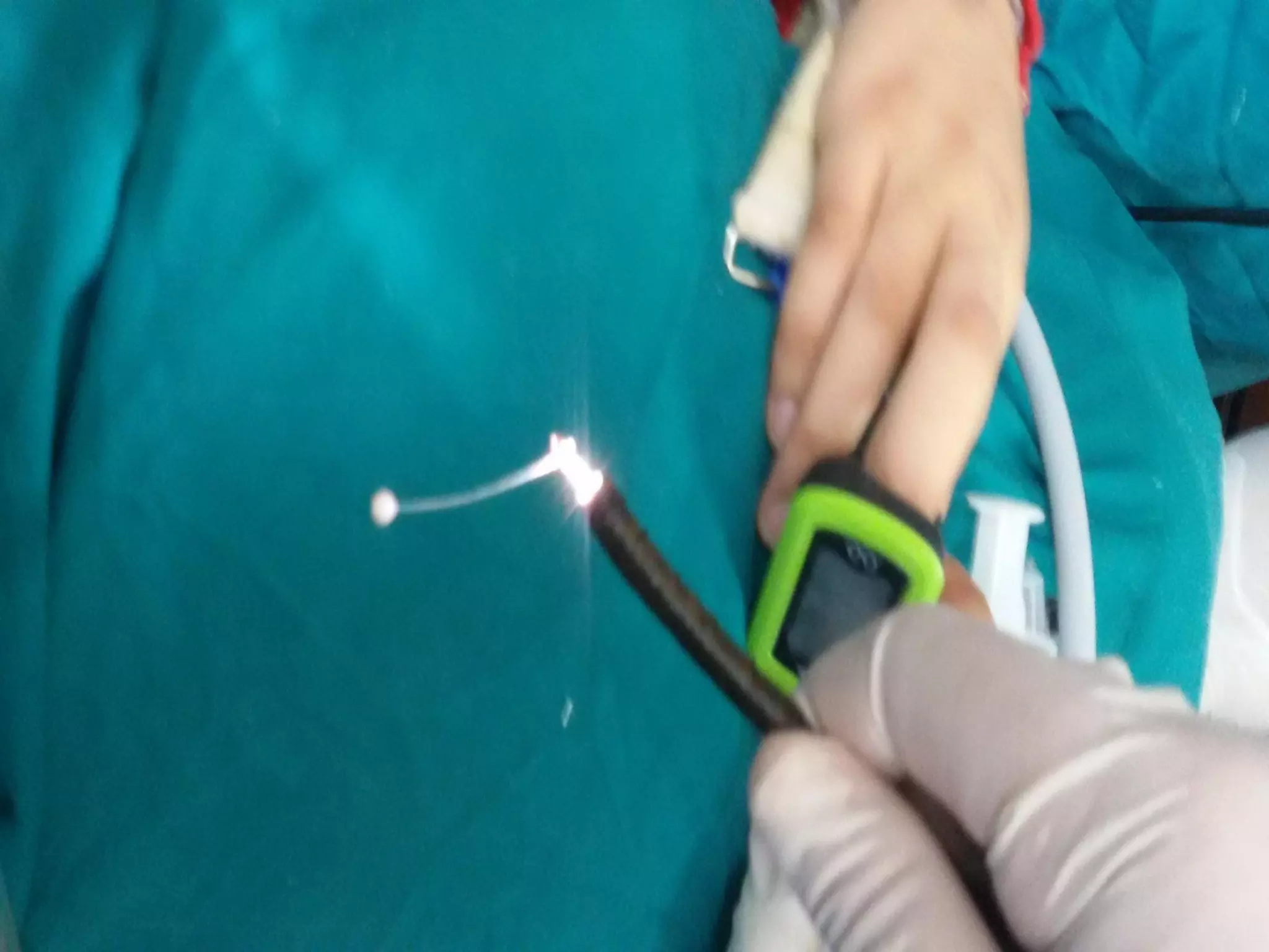 Role of fob in FB extraction | PDF