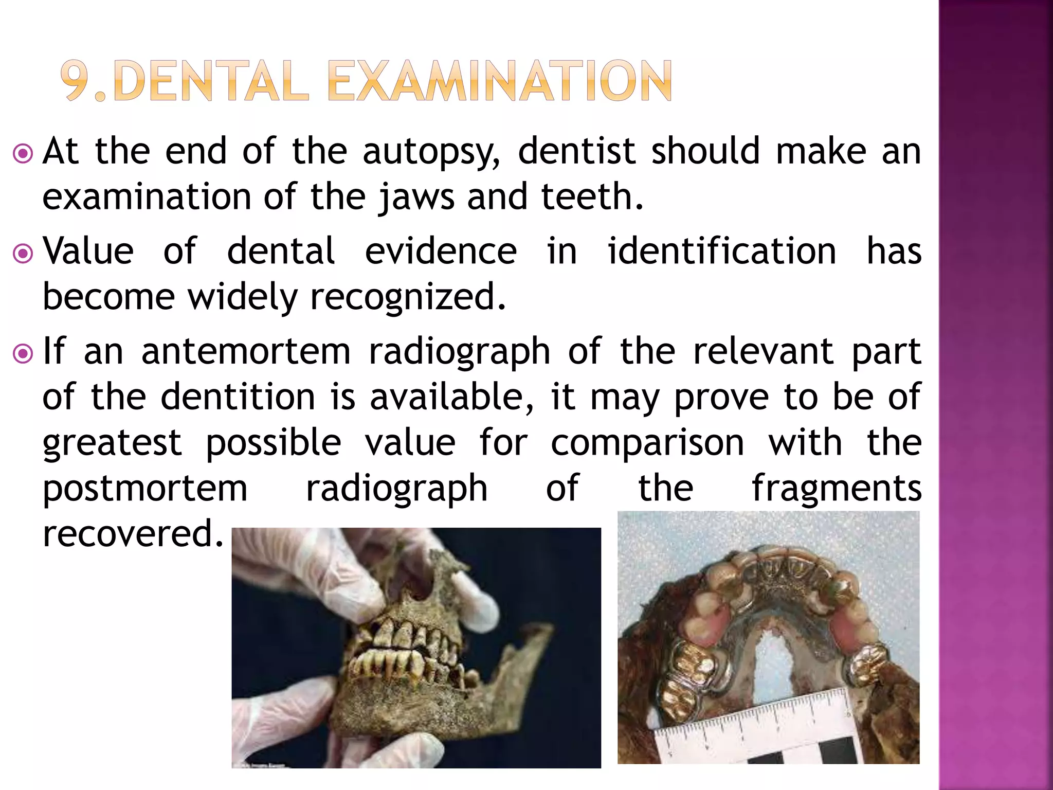 Role of Forensic Science in Mass Disaster Management | PPTX