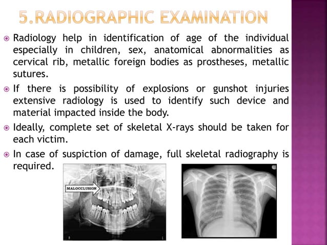 Role of Forensic Science in Mass Disaster Management | PPTX