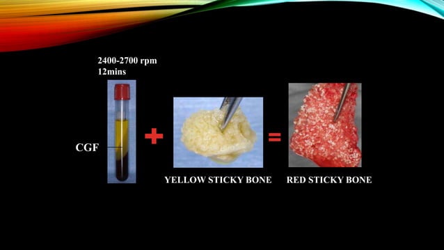 ROLE OF Growth factors IN PERIODONTAL REGENERATION.pptx | Blood ...