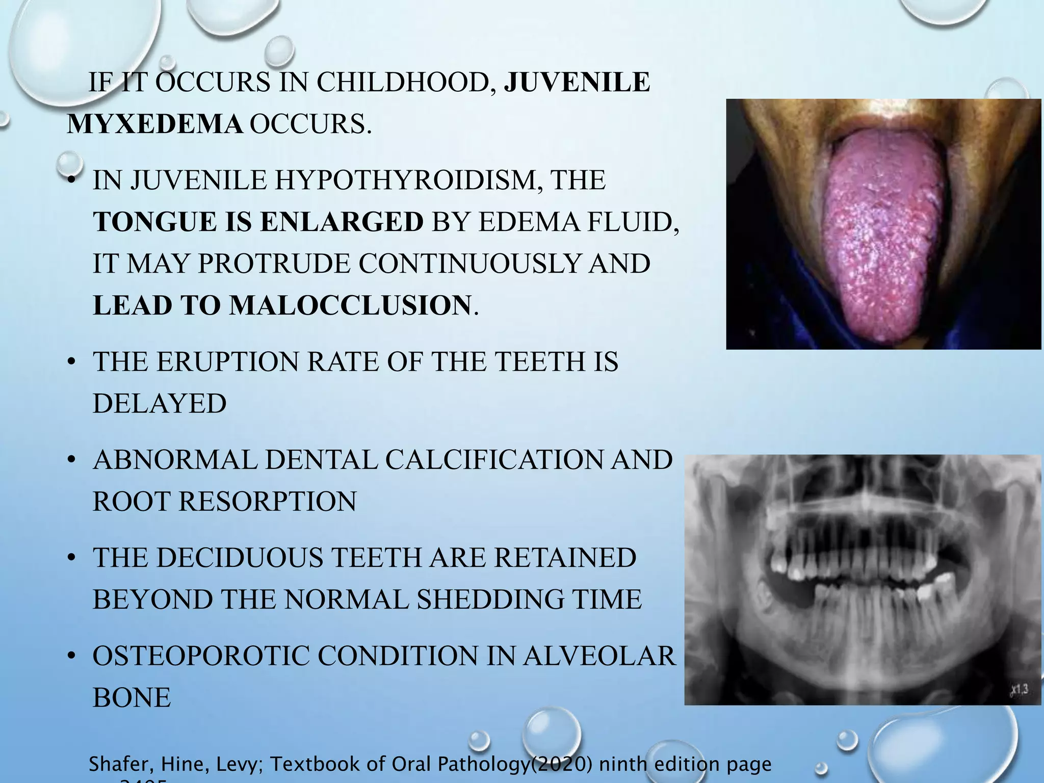 role of harmones and vitamins in craniofacial growth and development | PPTX