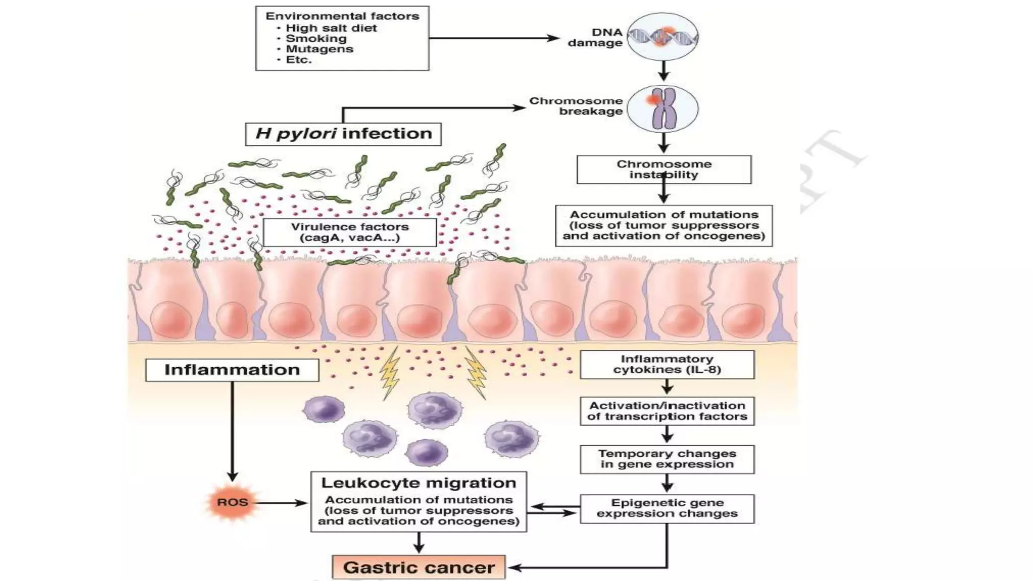 Role of helicobacter pylori in gastric cancer | PPTX