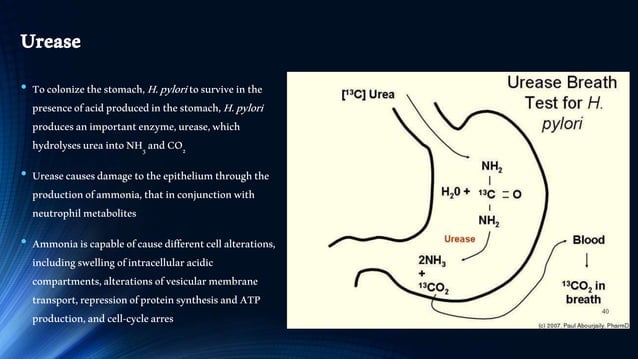 Role of helicobacter pylori in gastric cancer | PPTX | Digestive ...