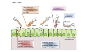 Role of helicobacter pylori in gastric cancer | PPTX