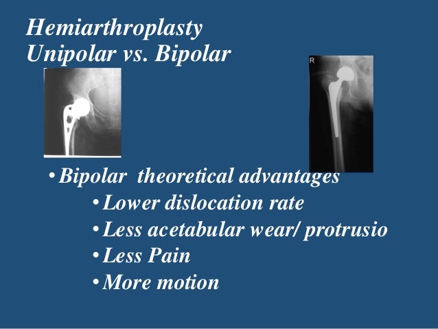 Role of hemiarthroplasty -30th aug 2015