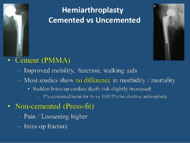 Role of hemiarthroplasty -30th aug 2015