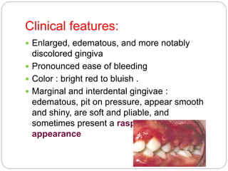 Role of hormones in periodontal health and disease | PPTX