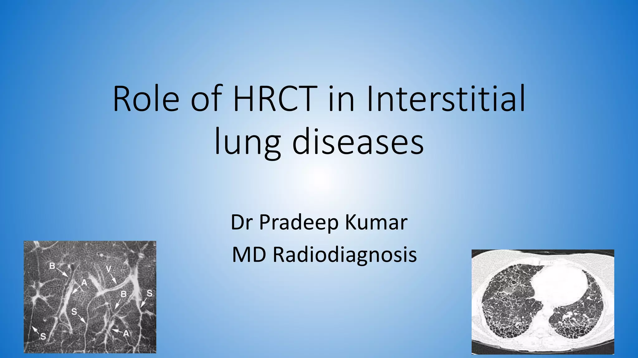 Role of hrct in interstitial lung diseases pk upload | PPTX