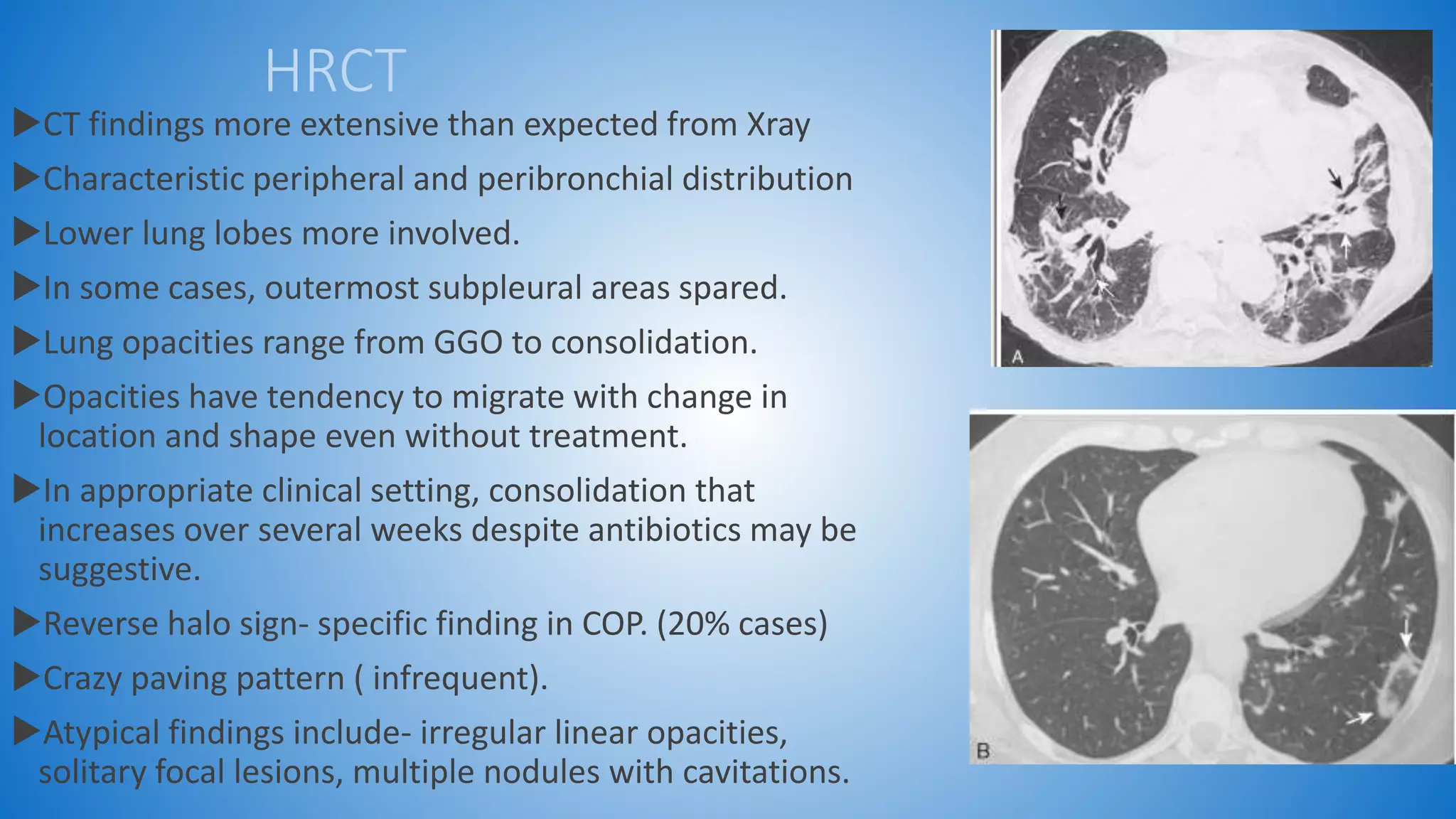 Role of hrct in interstitial lung diseases pk upload | PPTX