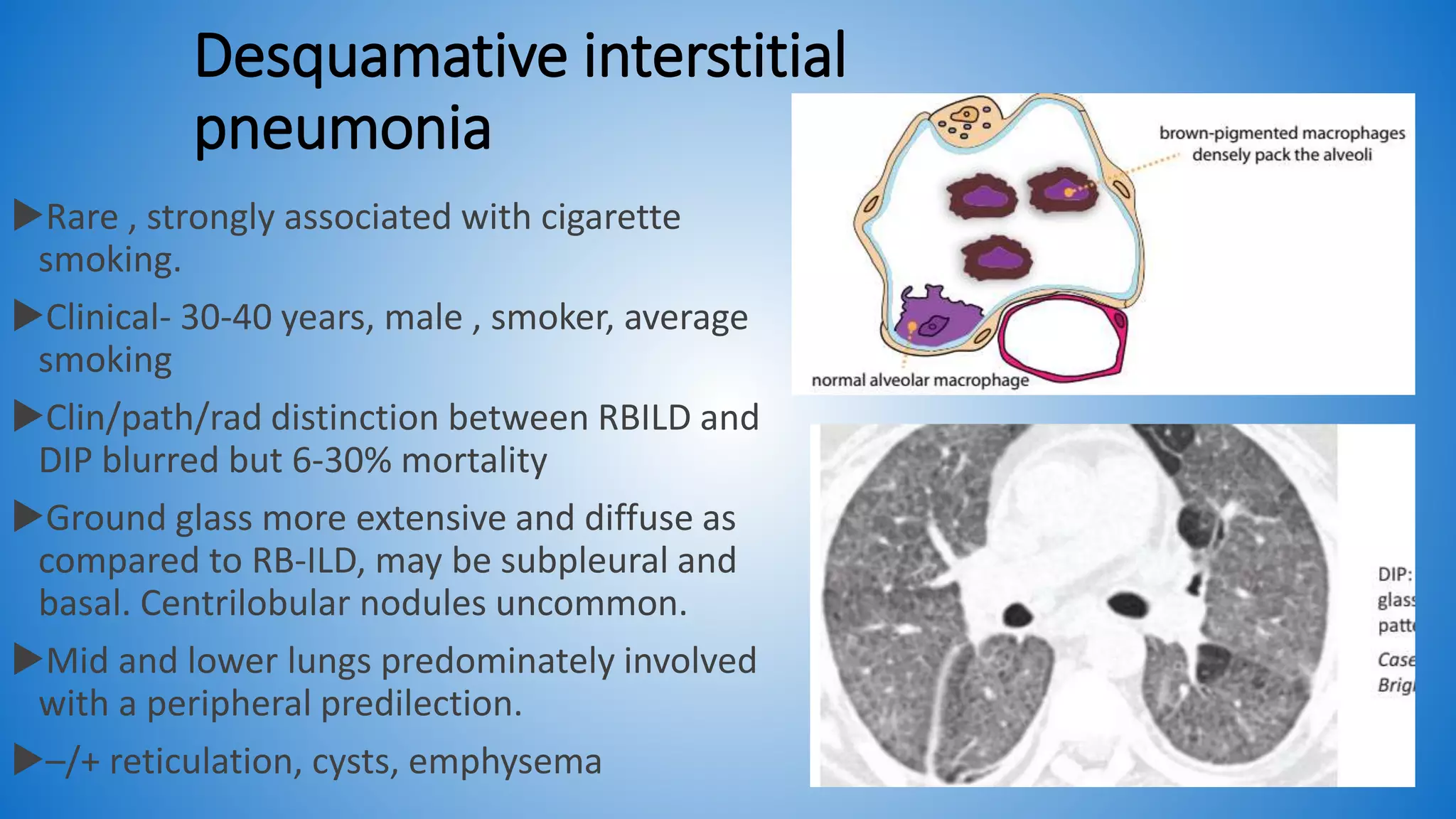 Role of hrct in interstitial lung diseases pk upload | PPTX