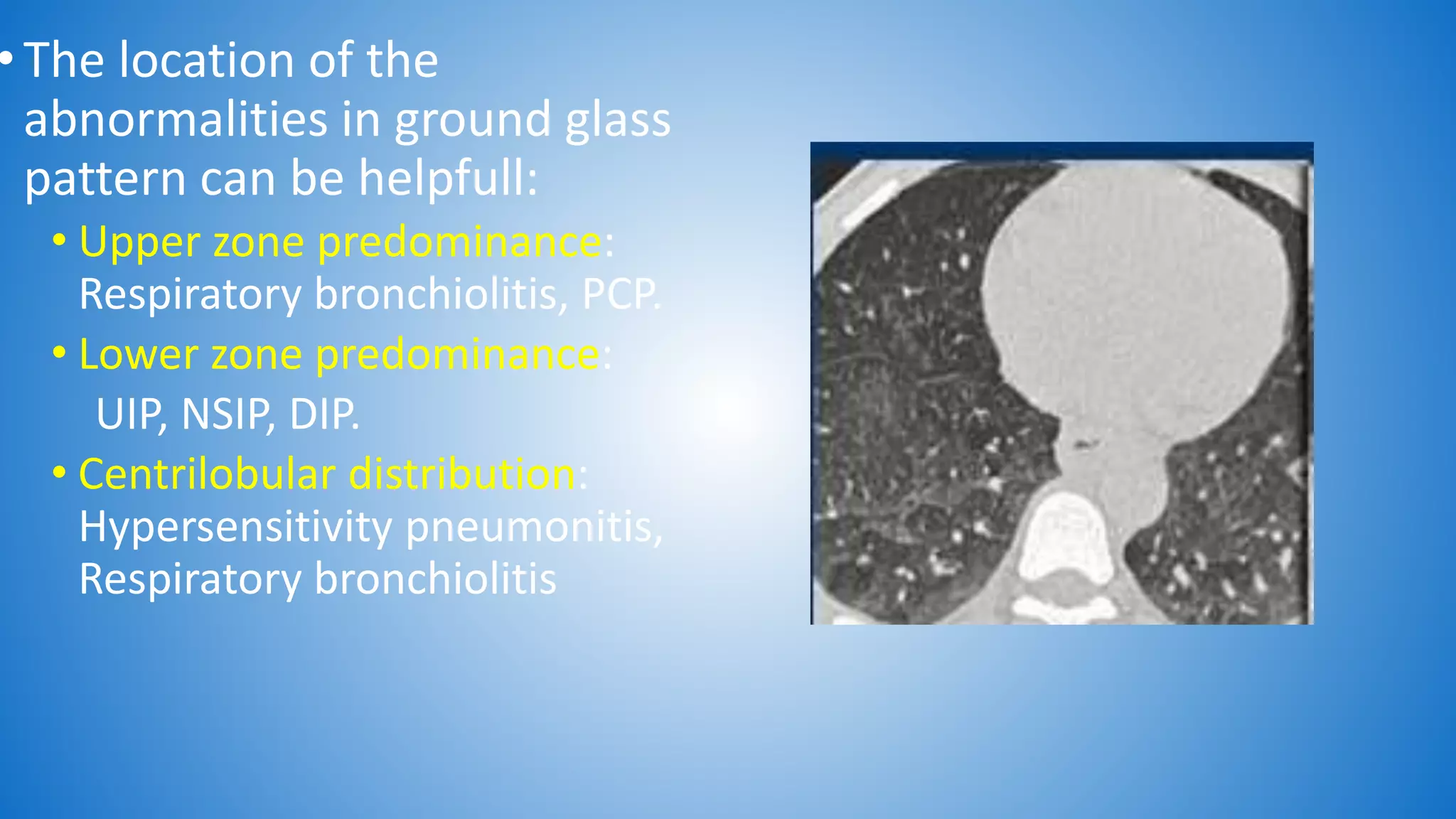 Role of hrct in interstitial lung diseases pk upload | PPTX