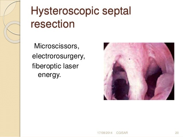 Role of hysteroscopy in Infertility, Dr Rajesh Gajbhiye