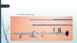 Role of hysteroscopy in infertility Management | PPTX