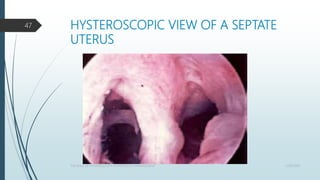 Role of hysteroscopy in infertility Management | PPT