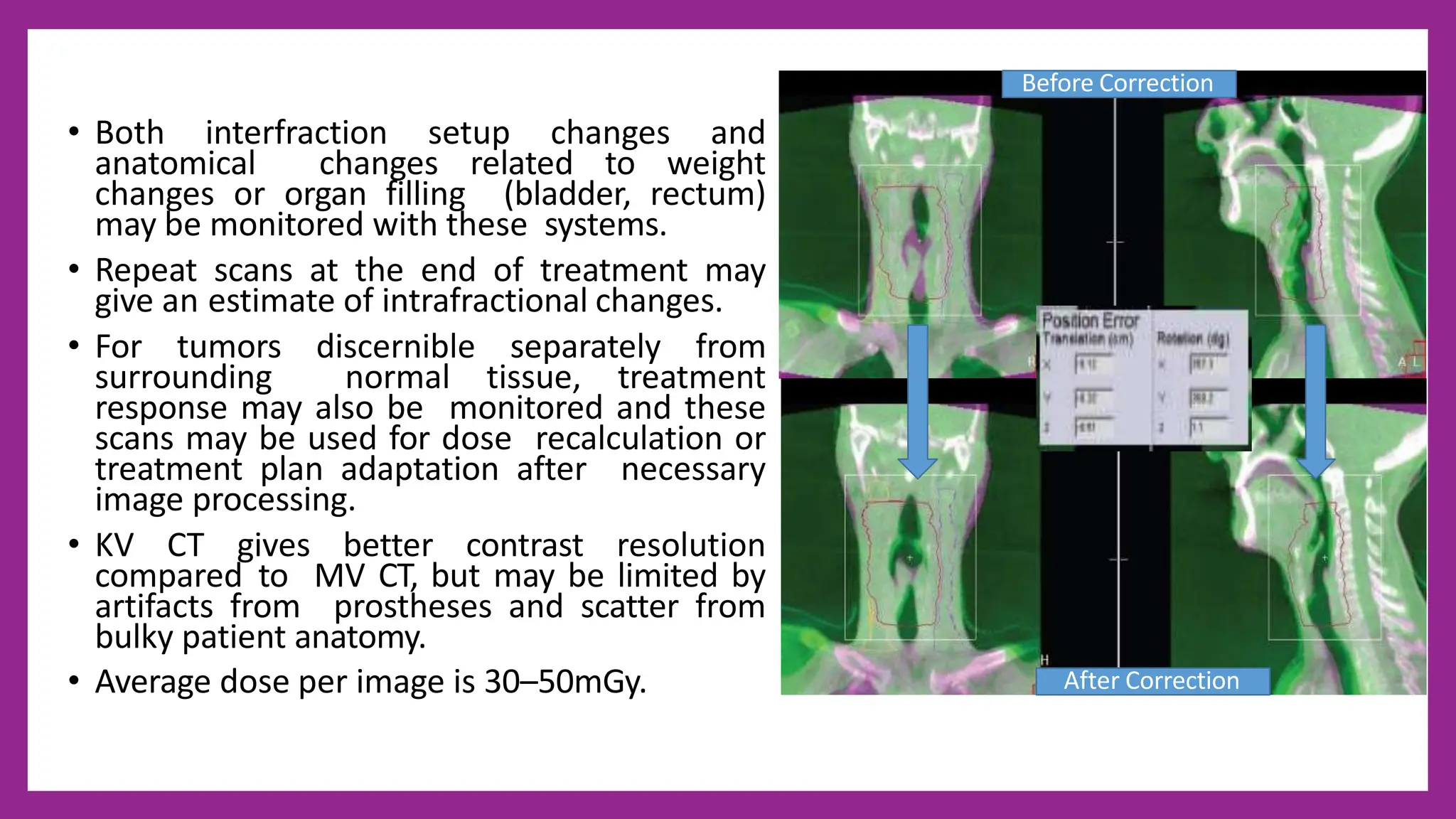 Role of Image Guidance in Radiotherapy | PPTX