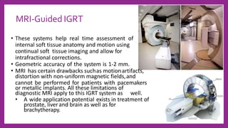 Role of Image Guidance in Radiotherapy | PPTX