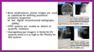 Role of Image Guidance in Radiotherapy | PPTX