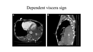 Role of Imaging in Abdominal Trauma.pptx