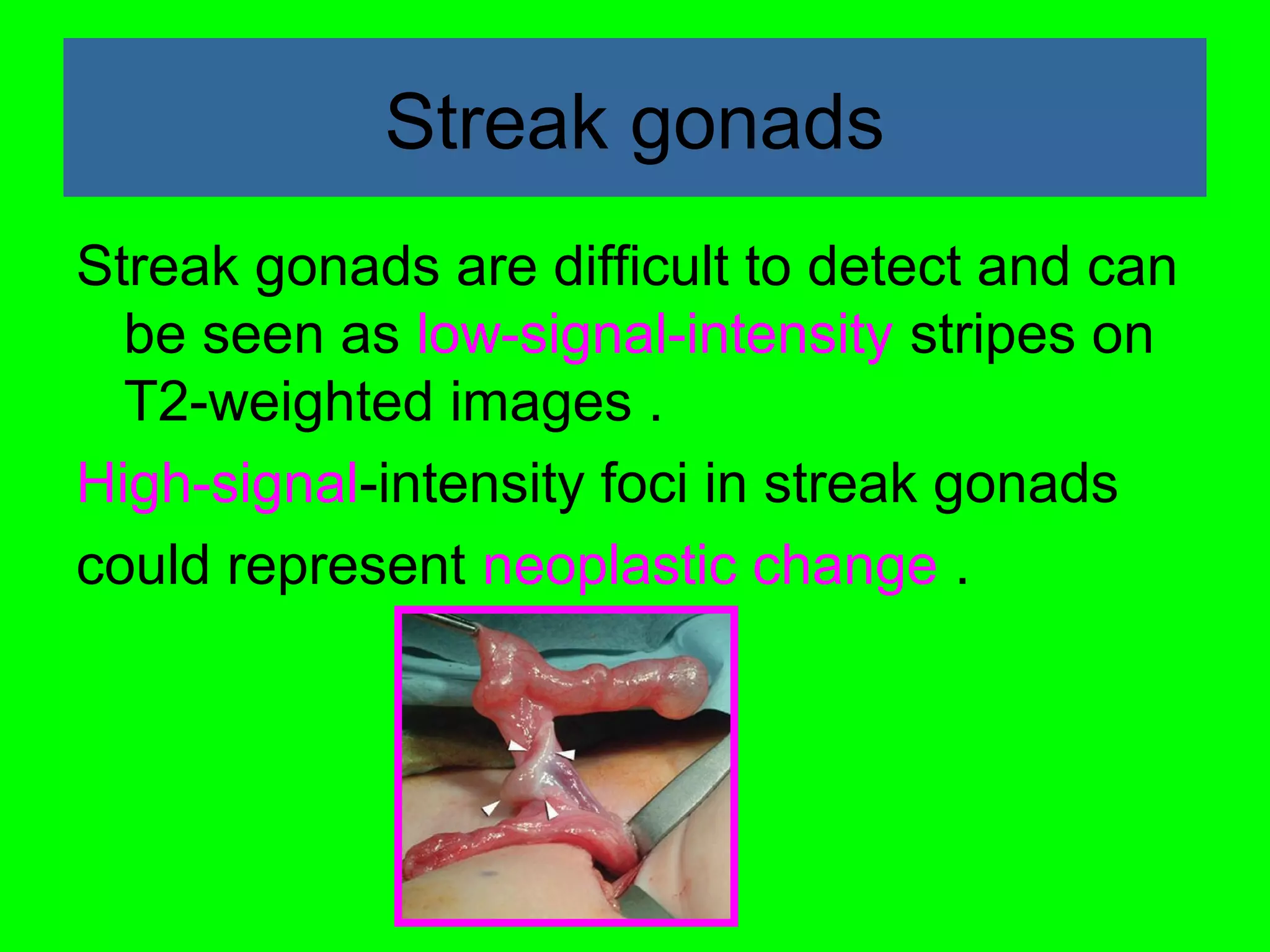 Role of imaging in ambiguous genitalia | PPT | Endocrine and Metabolic ...