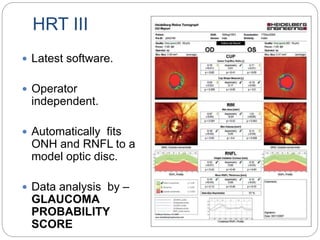 Role of imaging in glaucoma management | PPTX