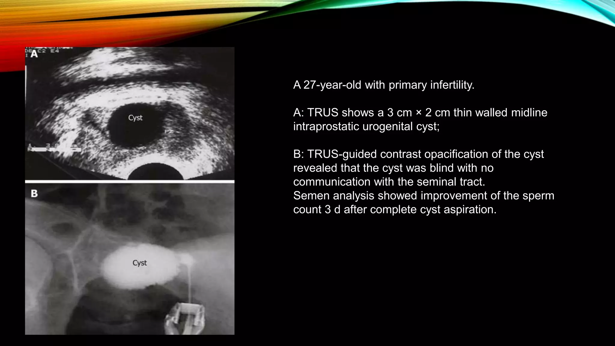 Role of Imaging in Male Infertility | PPTX