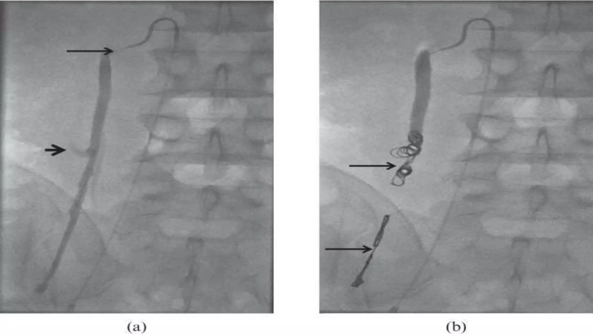 Role of Imaging in Male Infertility | PPTX