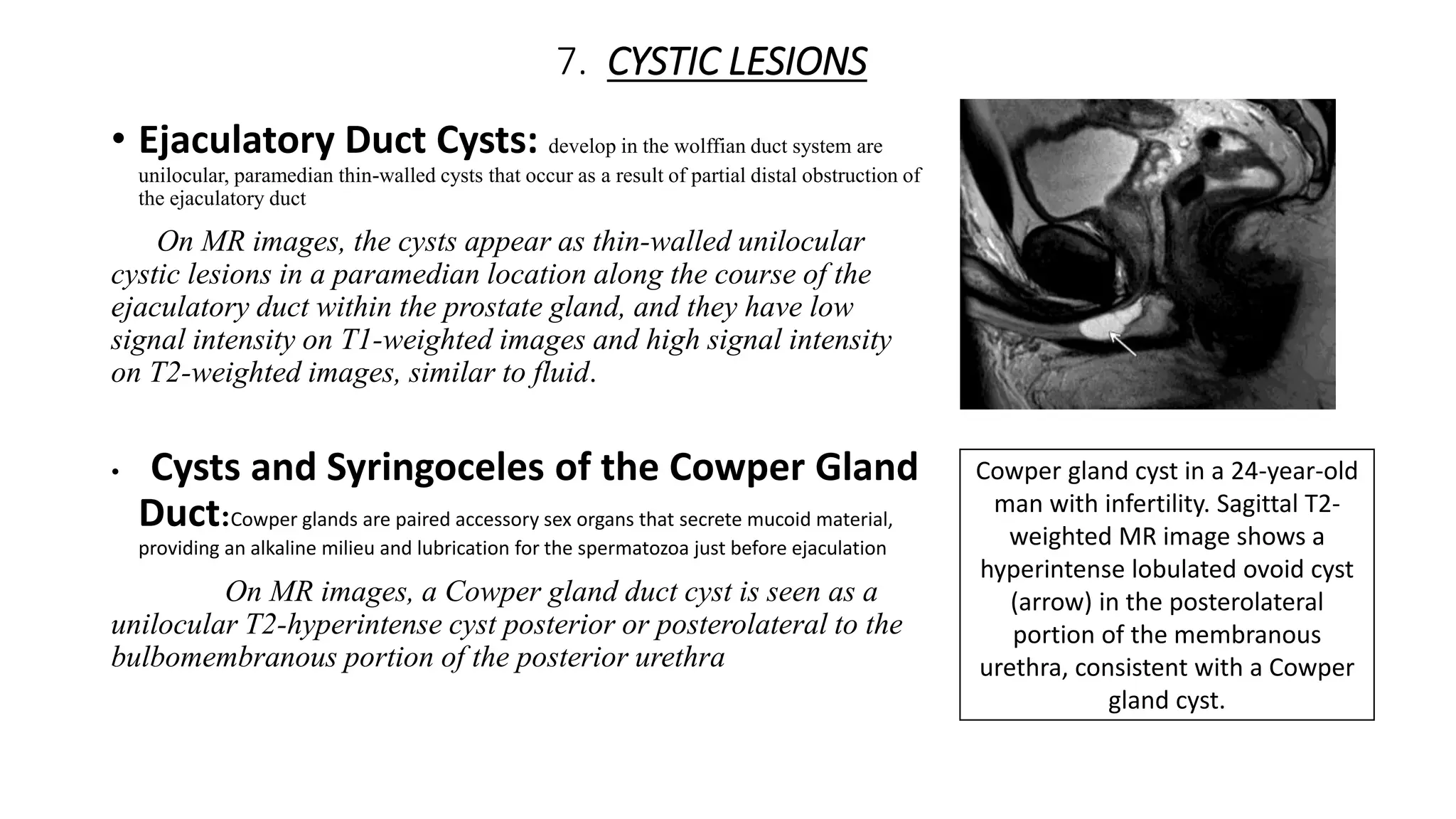 Role of imaging of diagnosis and management of male infertility | PPTX