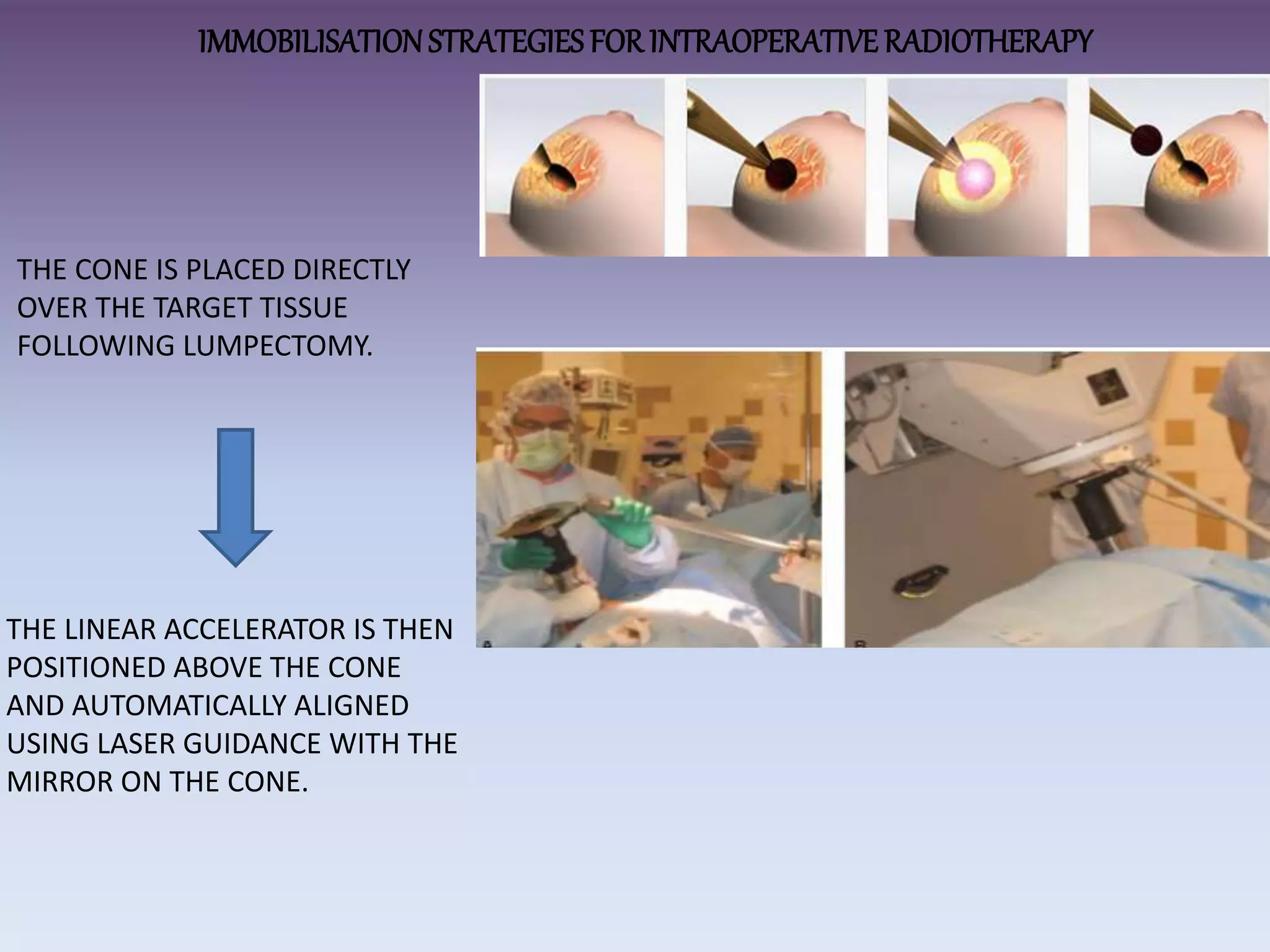 Role of immobilisation and devices in radiotherapy | PPTX