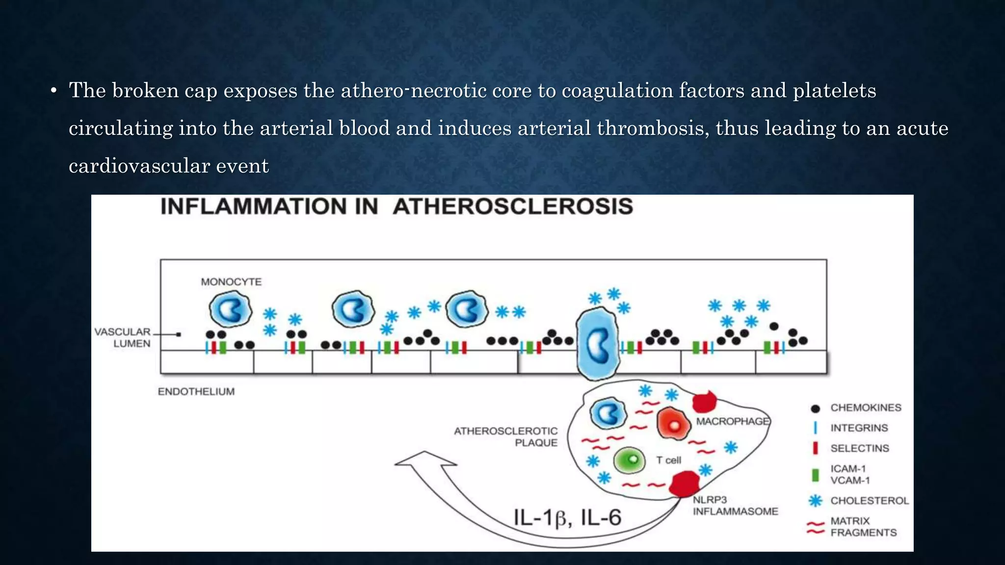 Role of inflamation in coronary artery disease | PPT