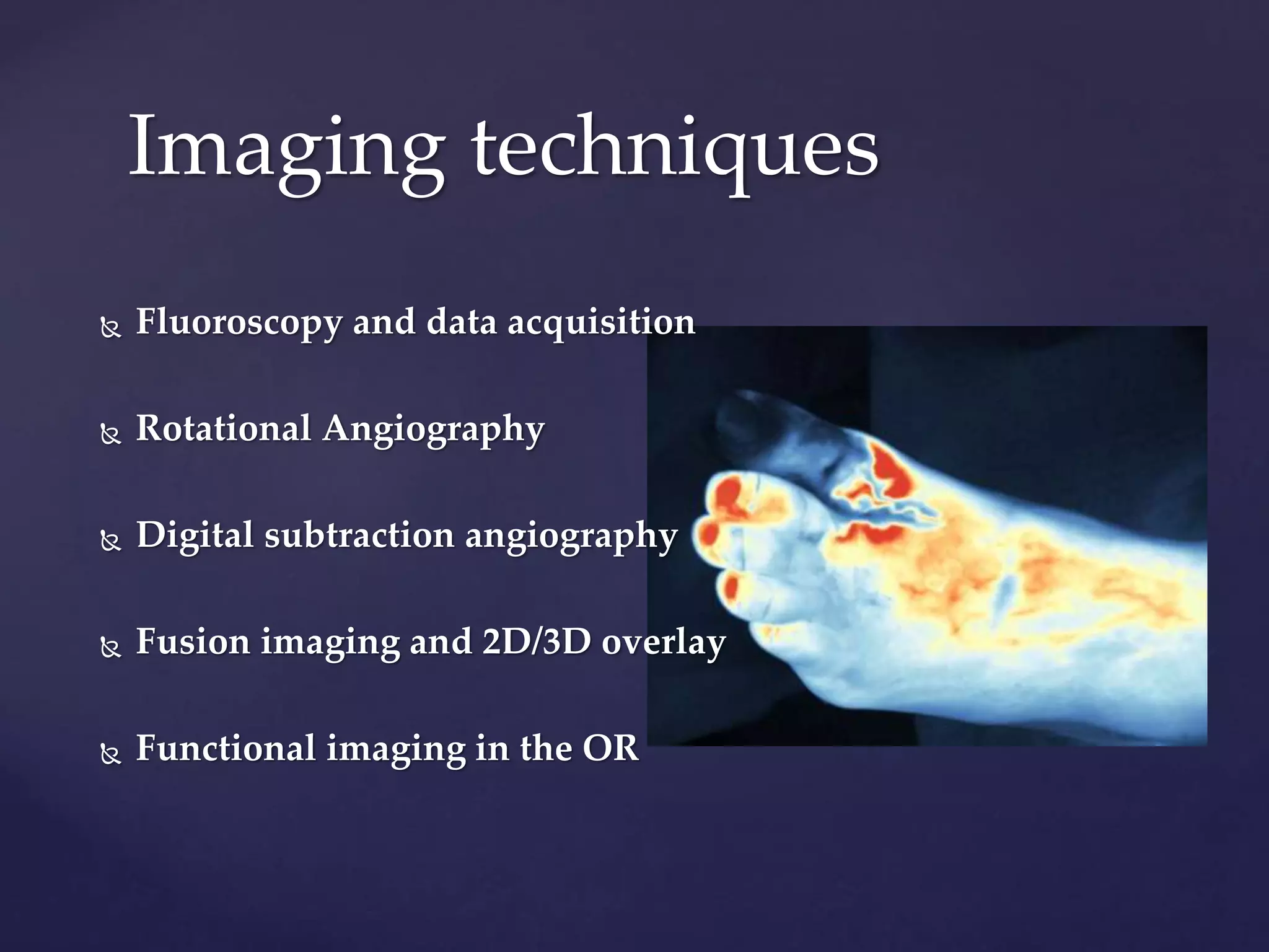 Role of intraoperative angiography in vascular surgery | PPT