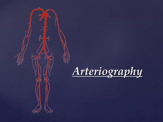 Role of intraoperative angiography in vascular surgery | PPT