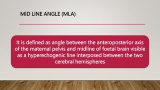 ROLE OF INTRAPARTUM ULTRASONOGRAPHY BMG.pptx