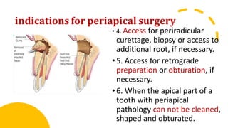 role of laser in periapical surgery rania asaad.pdf