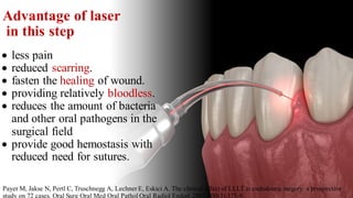 role of laser in periapical surgery rania asaad.pdf