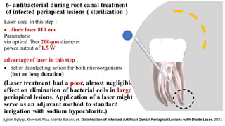 role of laser in periapical surgery rania asaad.pdf