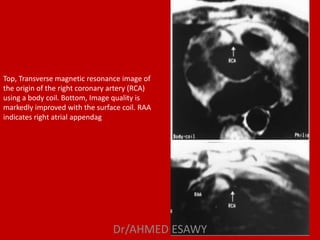 Role of magnetic resonance imaging in coronary artery disease MRCA part ...