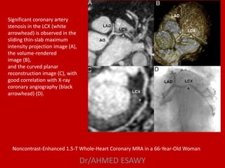 Role of magnetic resonance imaging in coronary artery disease MRCA part ...