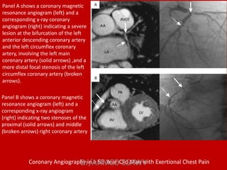 Role of magnetic resonance imaging in coronary artery disease MRCA part ...