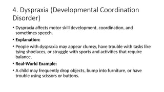 role of Major Learning Disabilities.pptx