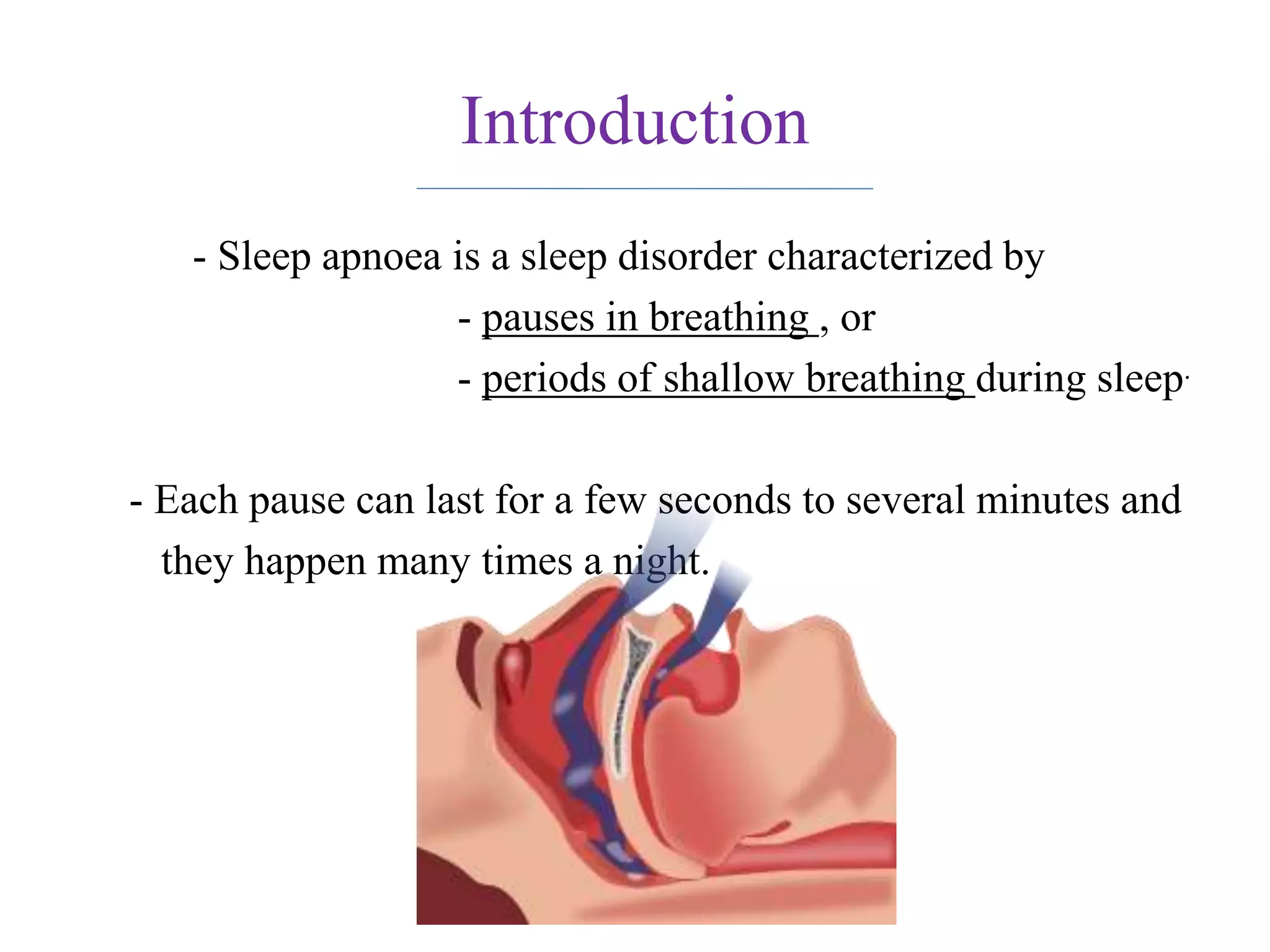 Role of mandibular advancement splint in sleep apnoea | PPTX