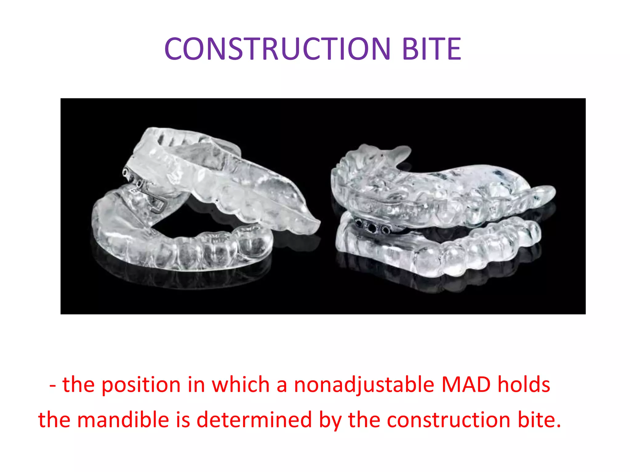 Role of mandibular advancement splint in sleep apnoea | PPTX