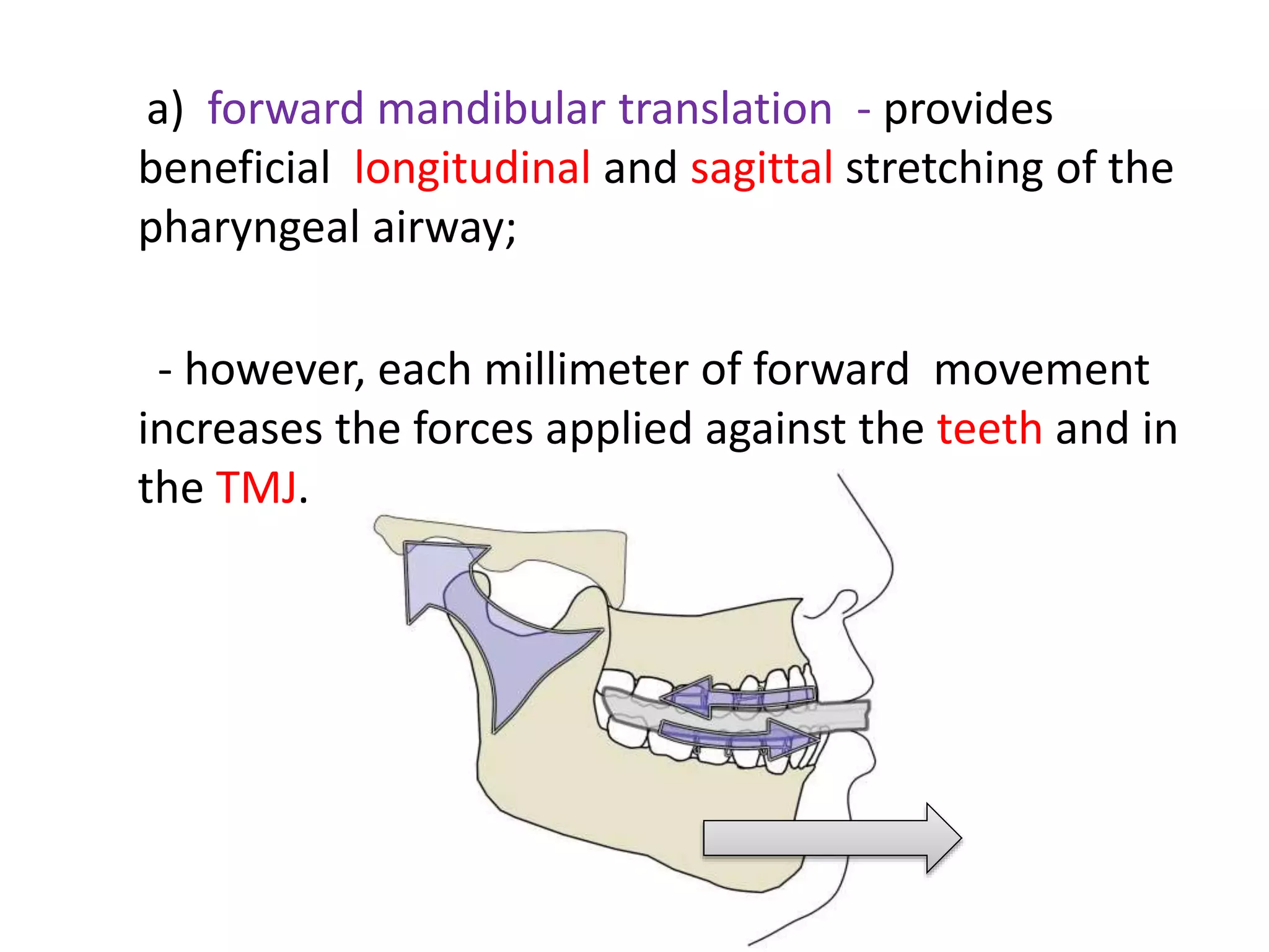Role of mandibular advancement splint in sleep apnoea | PPTX