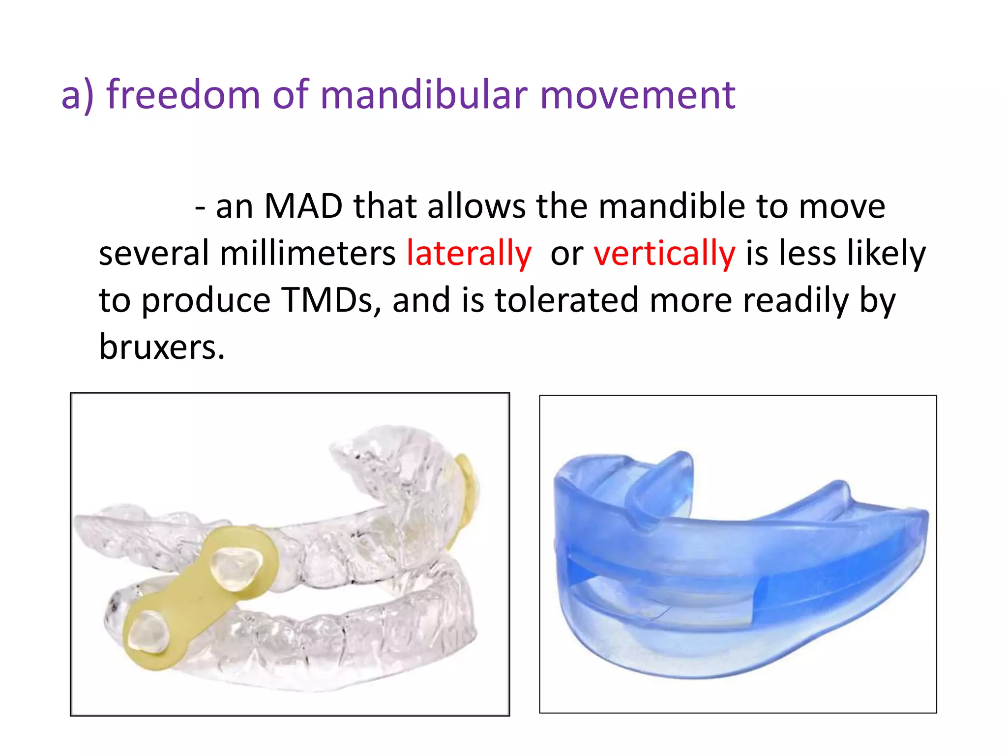 Role of mandibular advancement splint in sleep apnoea | PPTX
