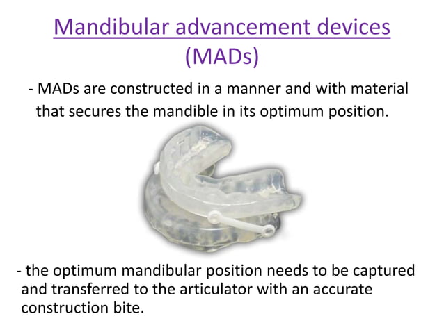 Role of mandibular advancement splint in sleep apnoea | PPTX | Ear ...