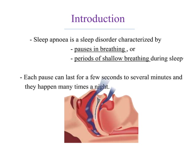 Role of mandibular advancement splint in sleep apnoea | PPTX | Ear ...